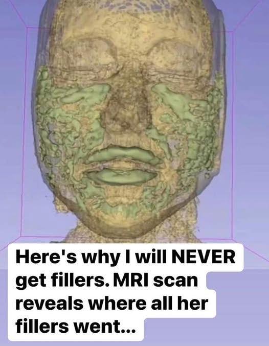 Doctor Reveals: MRI Scan Of The Face Of A 33-Year-Old Woman Reveals ...